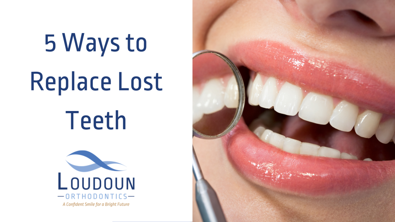 5 Ways to Replace Lost Teeth | Loudoun Orthodontics