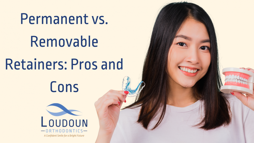Permanent vs. Removable Retainers: Pros and Cons