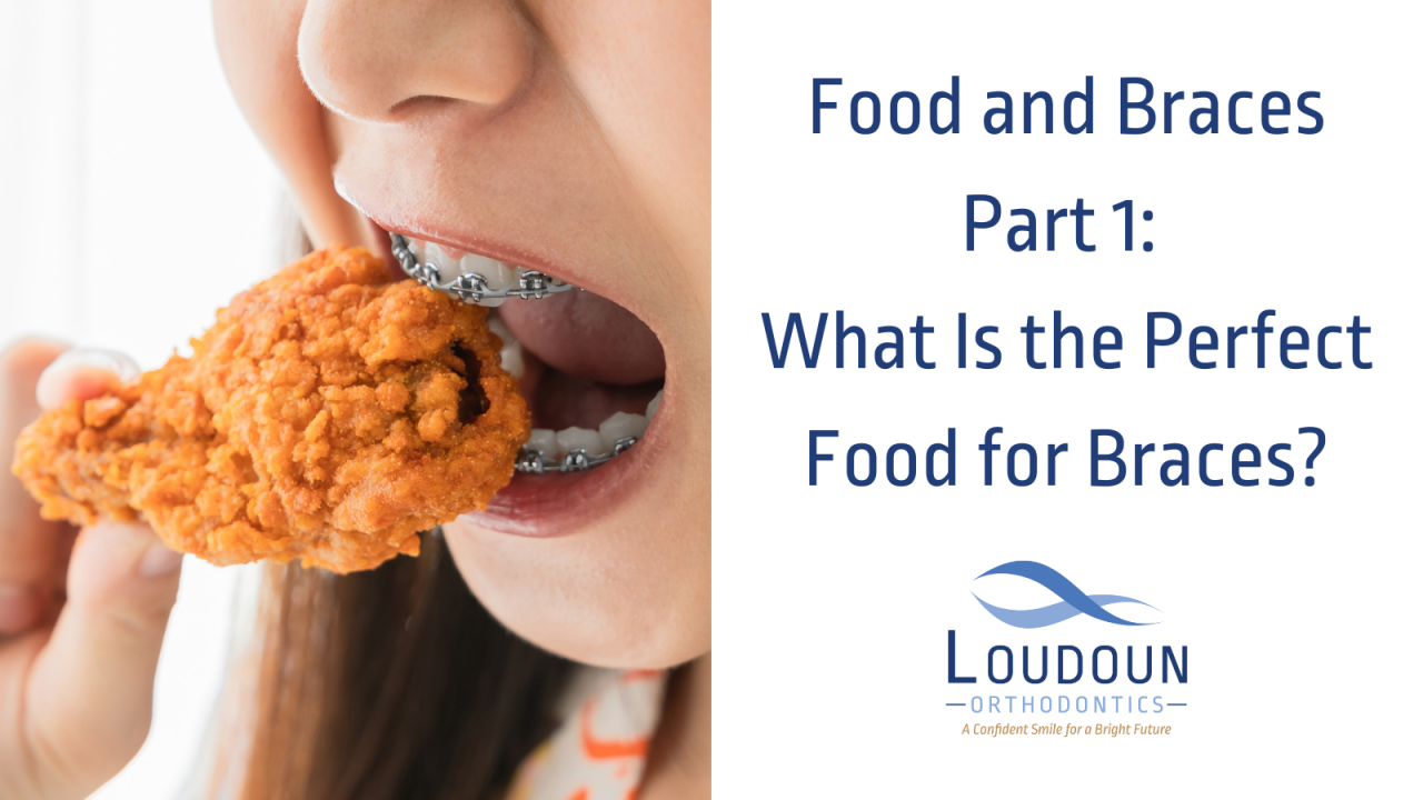 Food and Braces Part 1: What Is the Perfect Food for Braces?