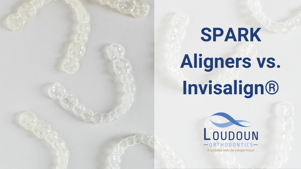 SPARK Aligners vs. Invisalign | Loudoun Orthodontics