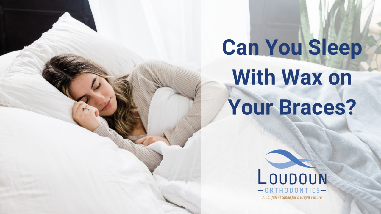 Can You Sleep With Wax On Your Braces
