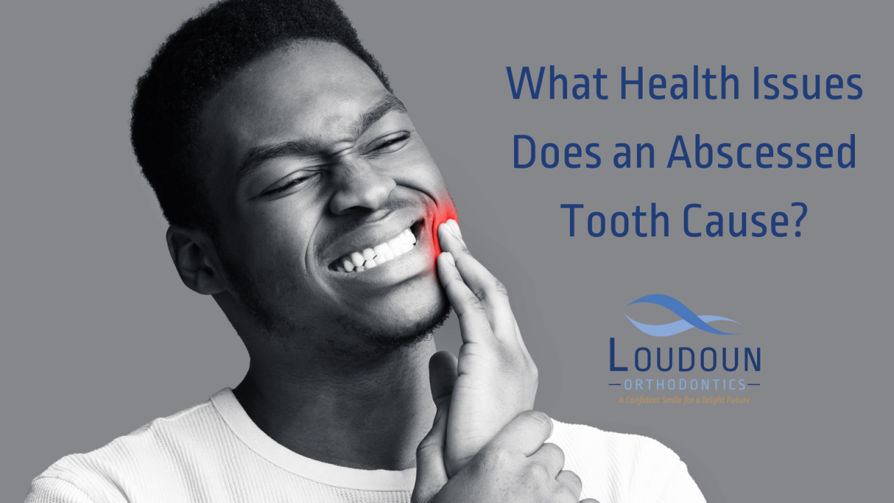 What Health Issues Does an Abscessed Tooth Cause?