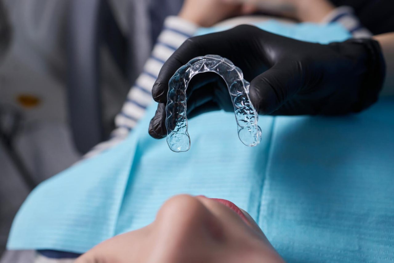 Dental Night Guards in Lansdowne, VA | Loudoun Orthodontics