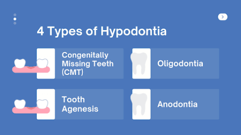5 Causes of Hypodontia or Missing Teeth