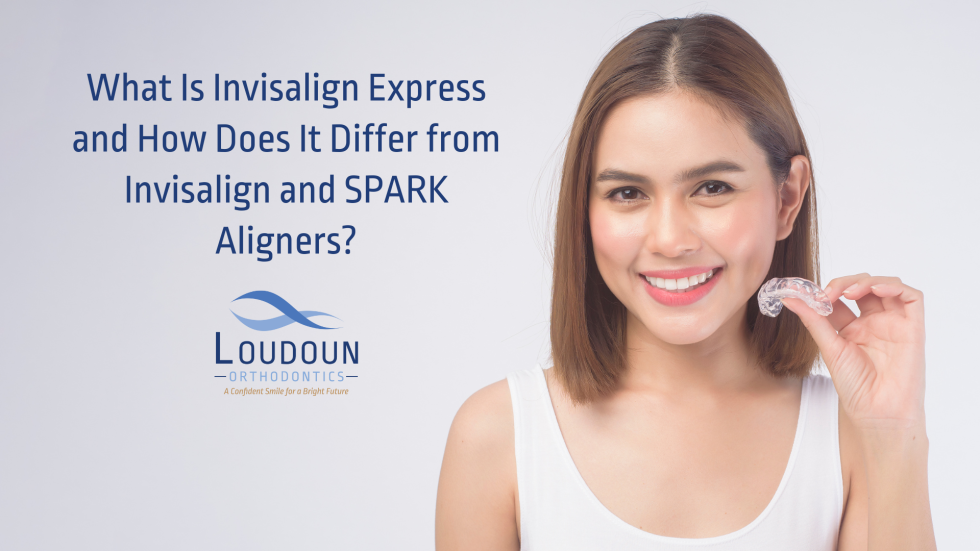 What Is Invisalign Express?