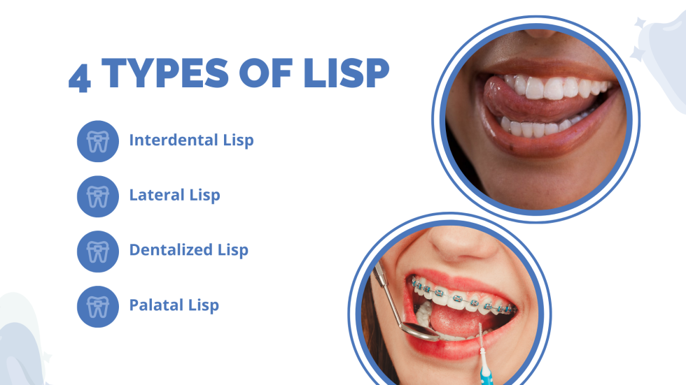 Can Braces Give You a Lisp?
