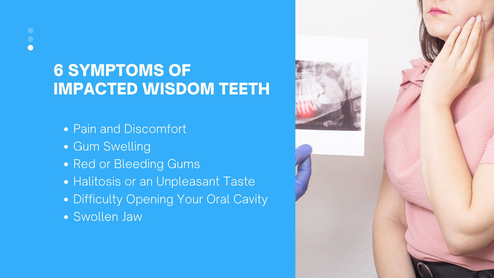 Impacted Wisdom Teeth: Symptoms and Treatment Options Impacted Wisdom Teeth: Symptoms and Treatment Options