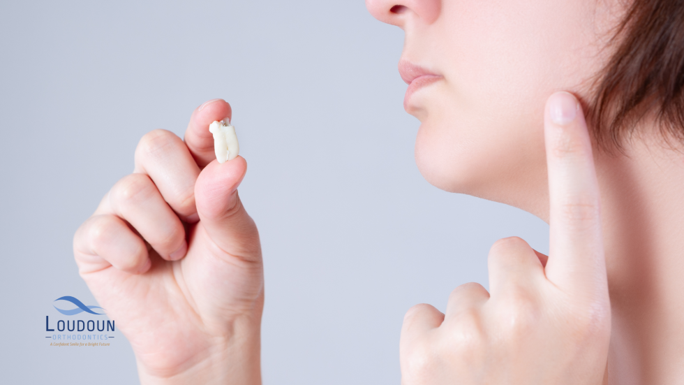 The Effects of Wisdom Teeth Removal on Face Shape