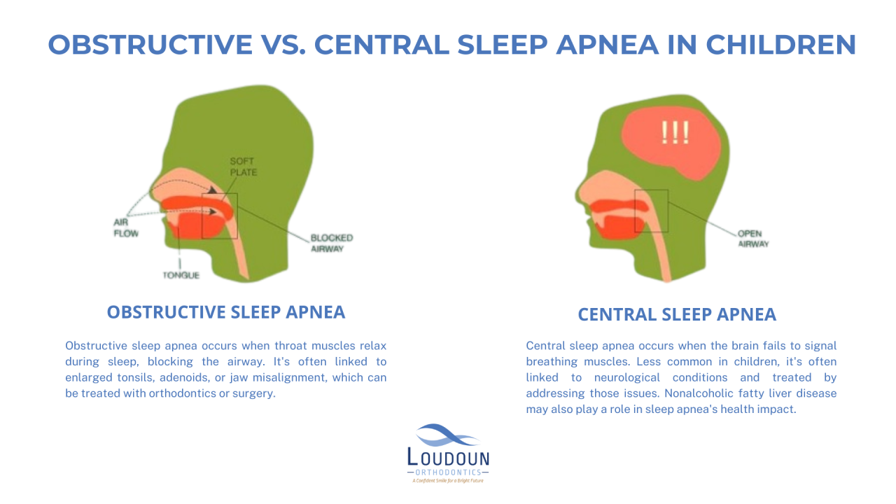 5 Effective Remedies for Pediatric Sleep Apnea